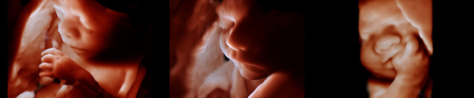 4D Pregnancy Ultrasound Fairfield | See Your Baby in Detail – No ...